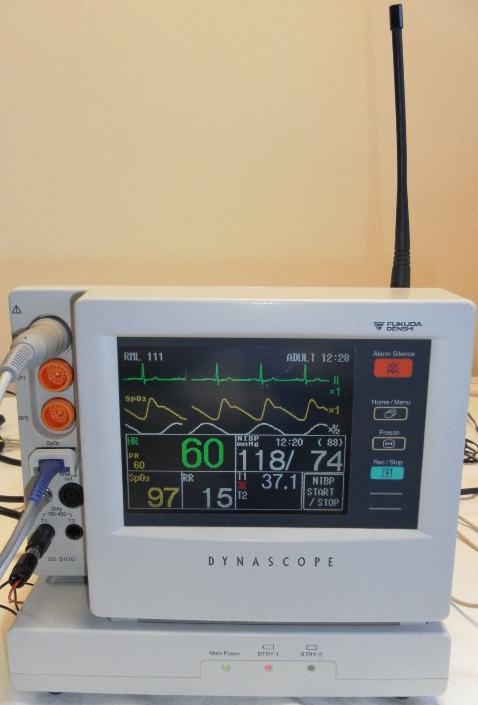 Fukuda Dynascope DS-5100E Portable monitor - Robin Medical Ltd