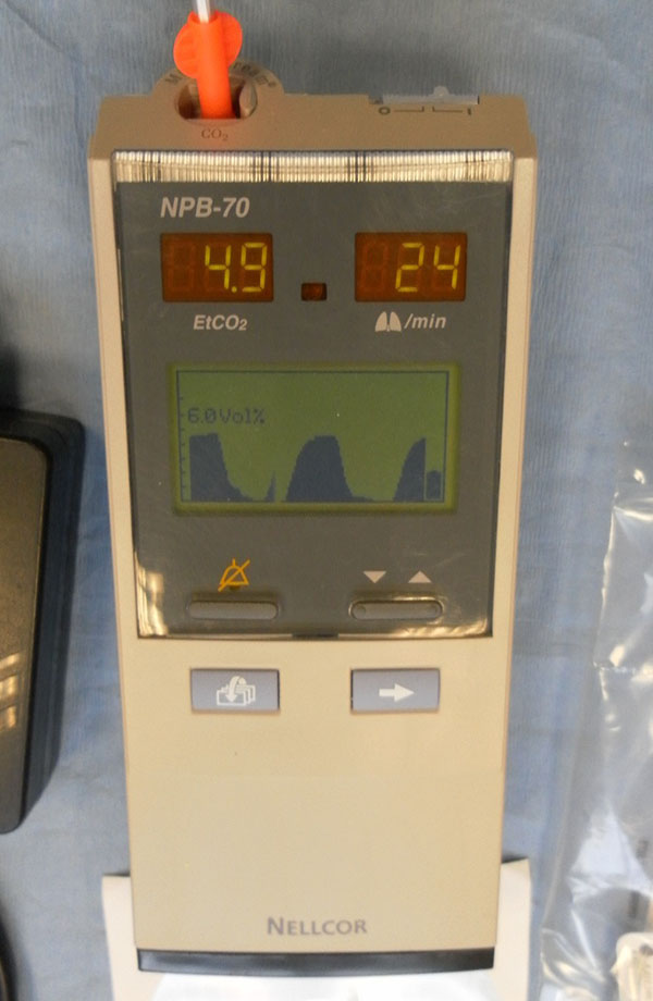 Nellcor NPB-70 Handheld Capnograph - Robin Medical Ltd