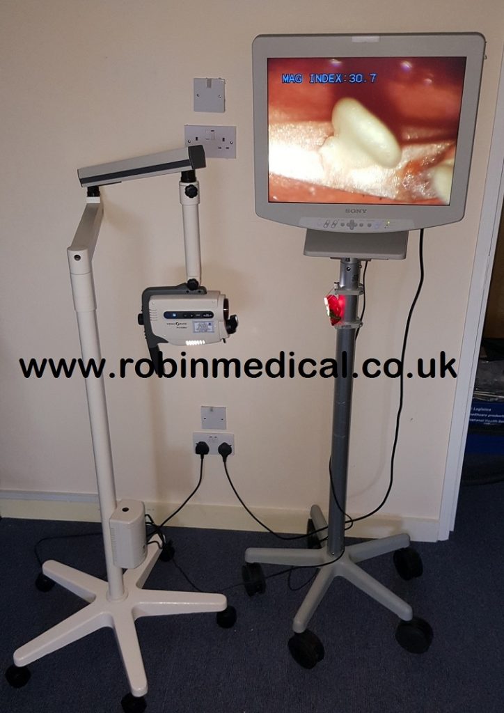 Welch Allyn VideoPath Digital Colposcope - Robin Medical Ltd