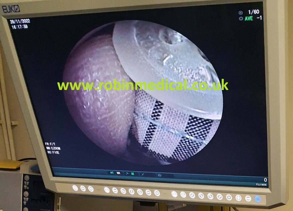 Fujinon EB-470S Bronchoscope - Robin Medical Ltd