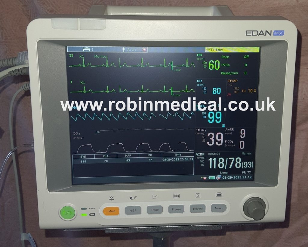 New Edan iM60 with etCO2 Patient Monitor - Robin Medical Ltd