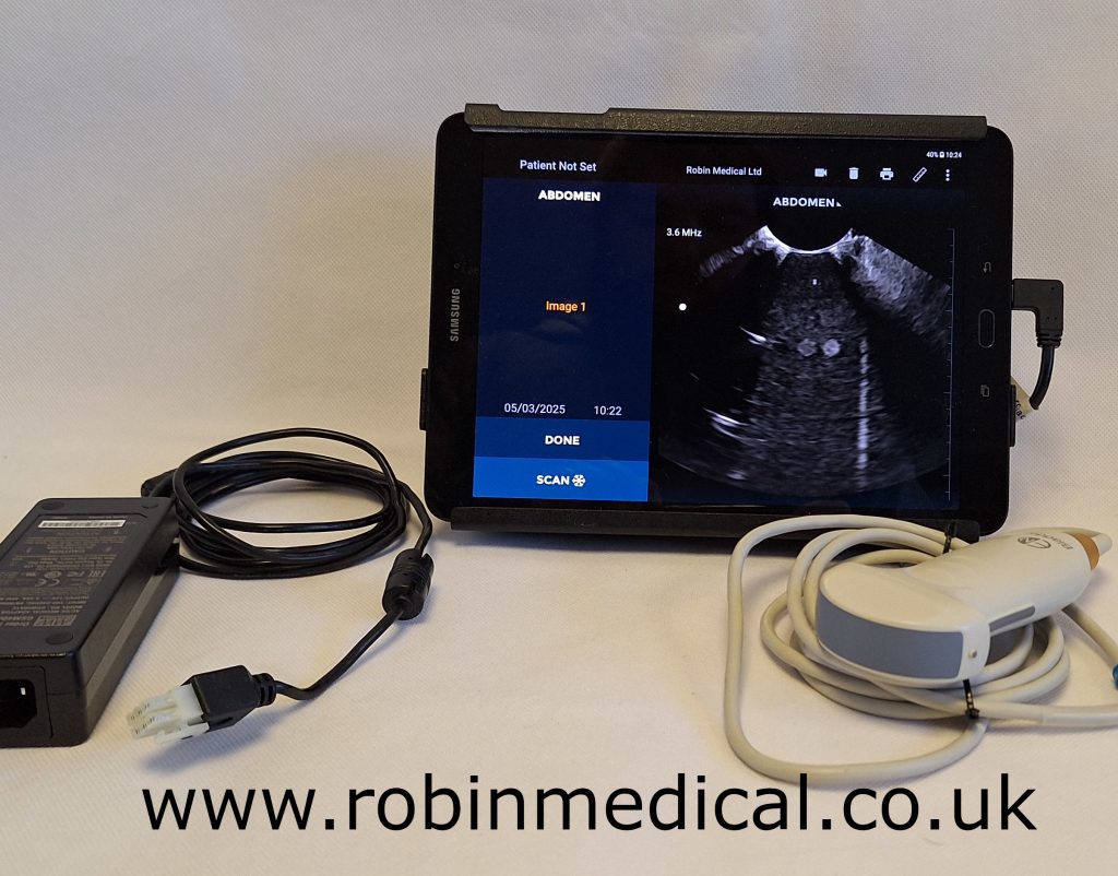 EchoNous Bladder Ultrasound Scanner + Abdominal Probe - Robin Medical Ltd